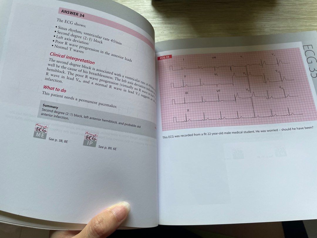 150 ECG Problems John R Hamptom, Hobbies & Toys, Books & Magazines, Textbooks on Carousell