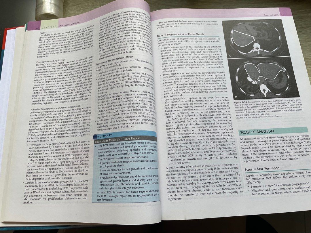 Robins Basic Pathology Ninth Edition, Hobbies & Toys, Books & Magazines ...