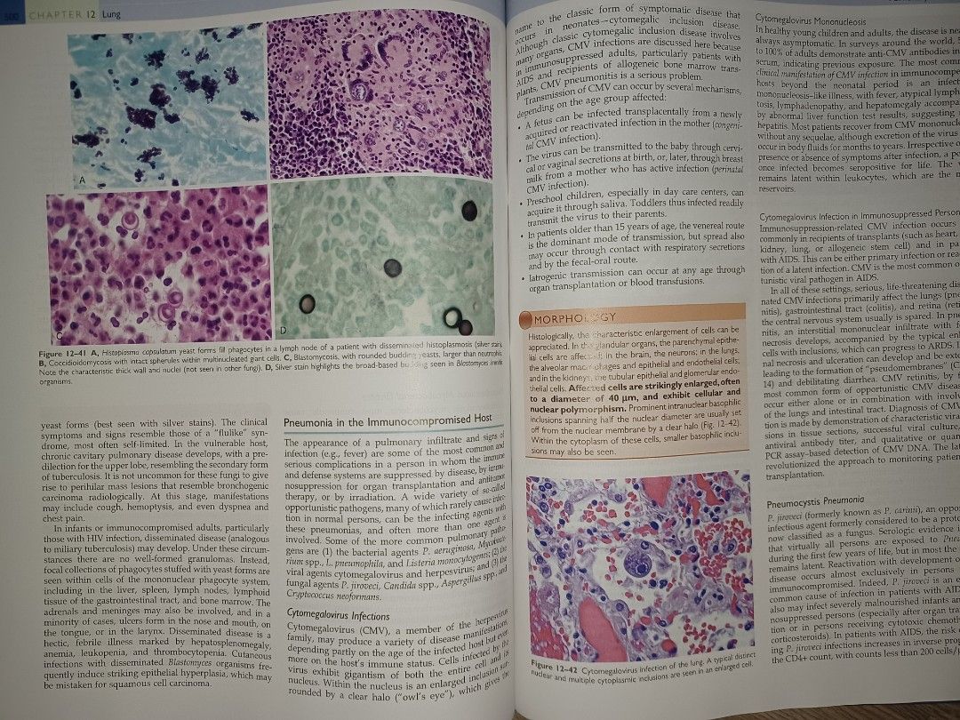 Robbins Basic Pathology Int Ed, 9th ed, Hobbies & Toys, Books ...