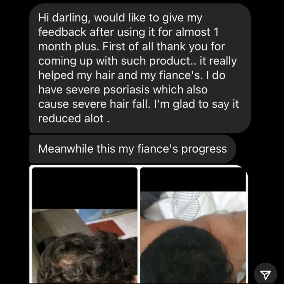 Debha ayurveda hair oil, Beauty & Personal Care, Hair on Carousell