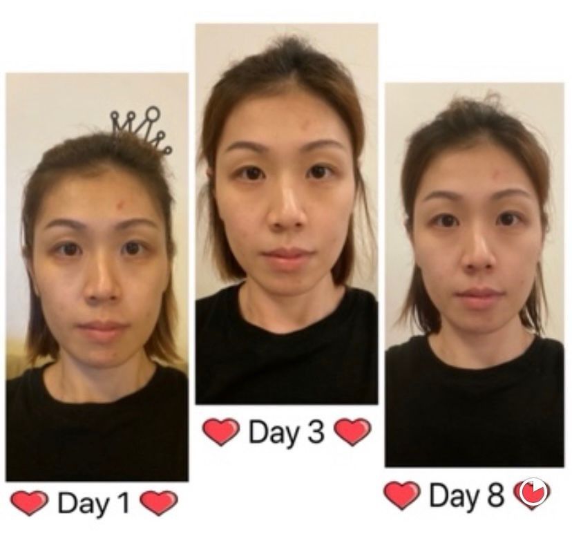 Stemey Dr Sys Ampoule, Beauty & Personal Care, Face, Face Care on Carousell