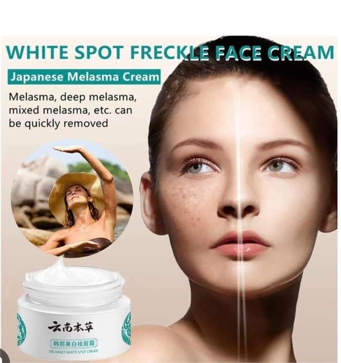 Dr. Hancy melasma cream, 美容＆化妝品, 健康及美容 - 皮膚護理, 面部 - 面部護理 - Carousell