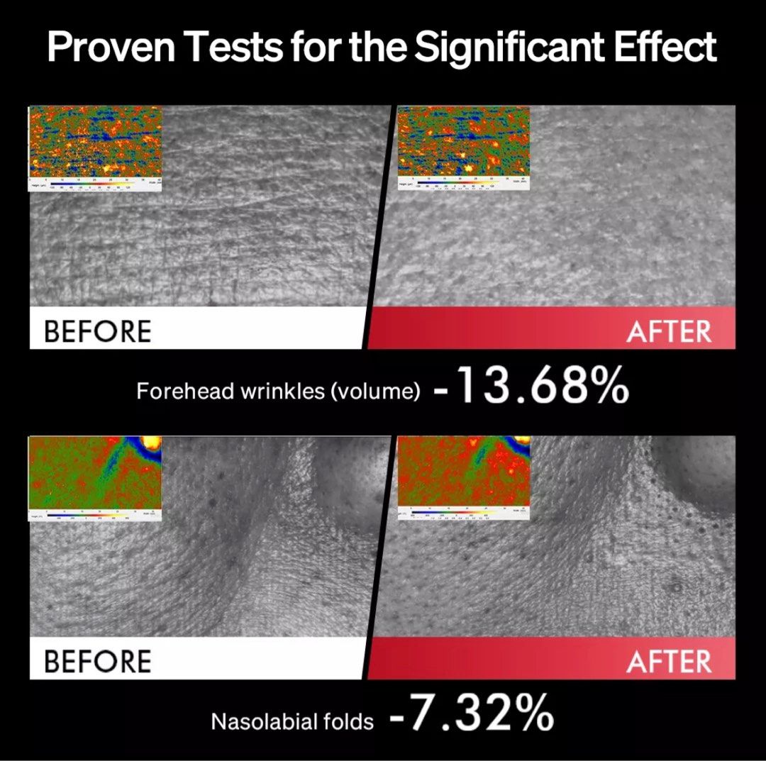 Ulike X Jmoon 12 - Electrode Oversize Rapidlift Beauty Device 3x Lift ...