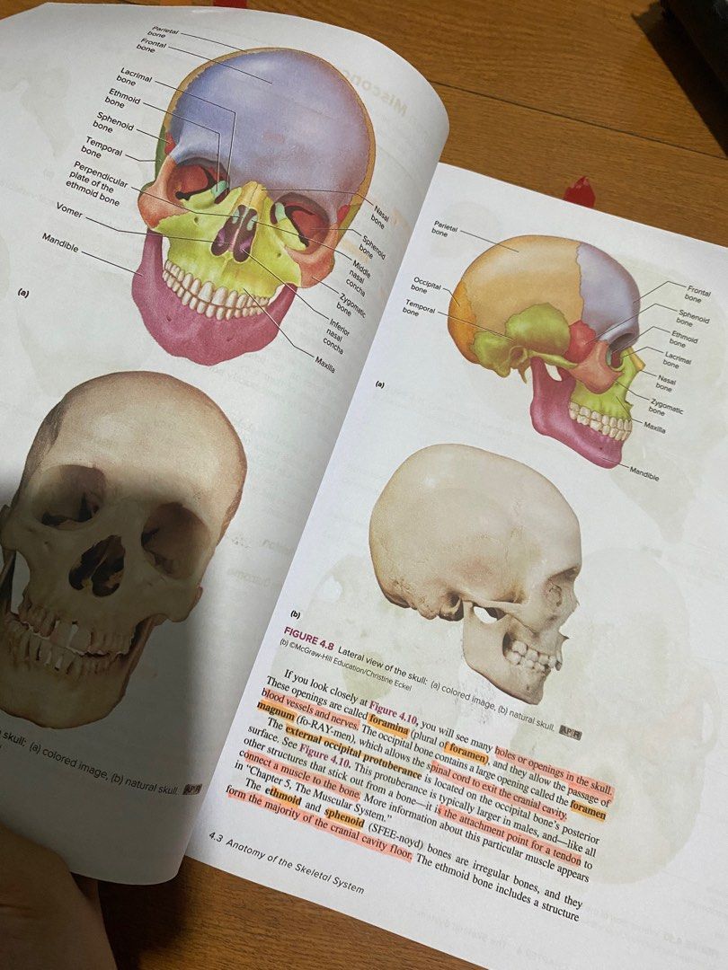 Roiger and Bullock Anatomy, Physiology & Disease, Hobbies & Toys, Books ...