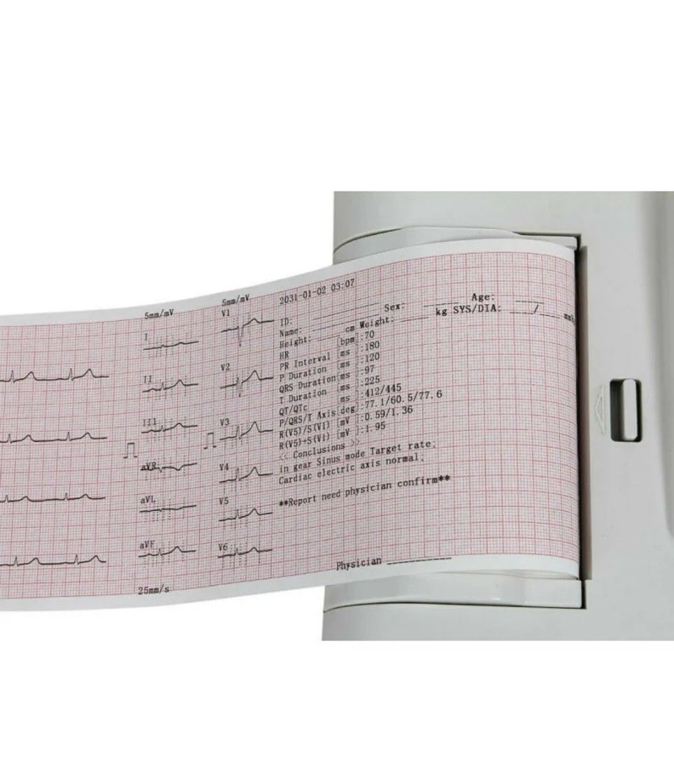 Electrocardiogram ECG 600G, Health & Nutrition, Health Monitors ...