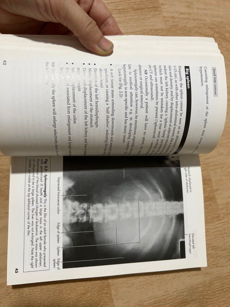 Abdominal X- rays made Easy, Hobbies & Toys, Books & Magazines ...