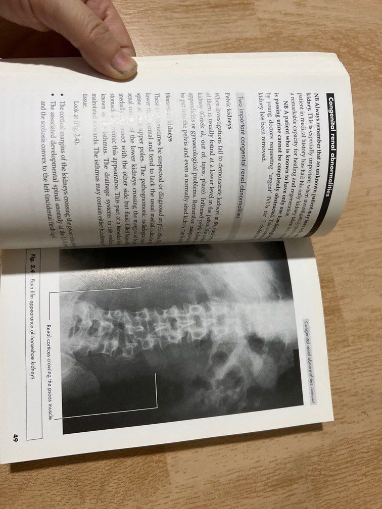 Abdominal X- rays made Easy, Hobbies & Toys, Books & Magazines ...