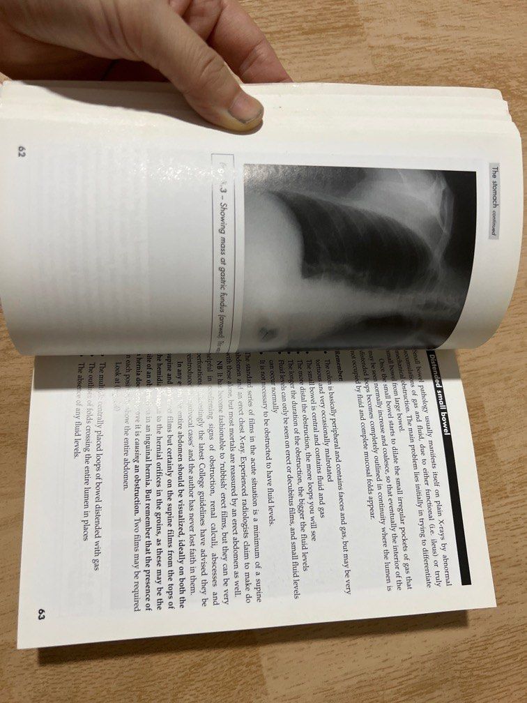 Abdominal X- rays made Easy, Hobbies & Toys, Books & Magazines ...