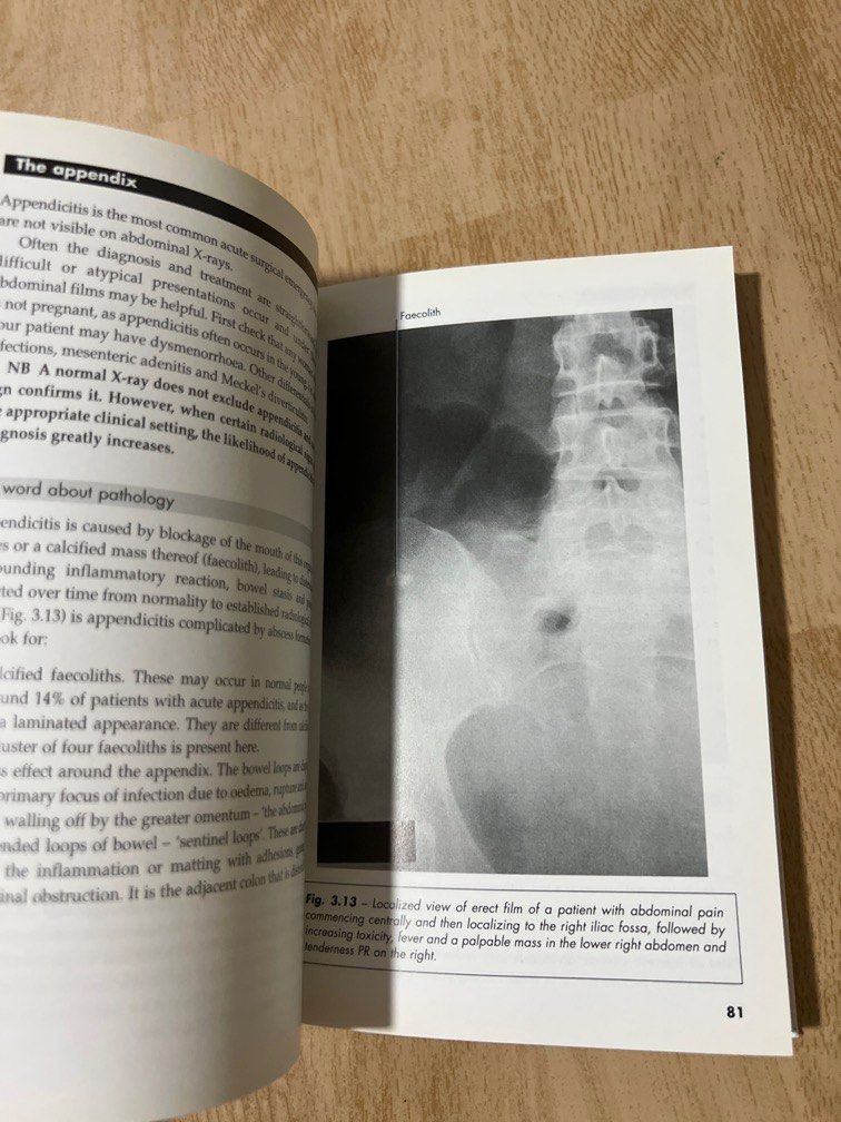 Abdominal X- rays made Easy, Hobbies & Toys, Books & Magazines ...