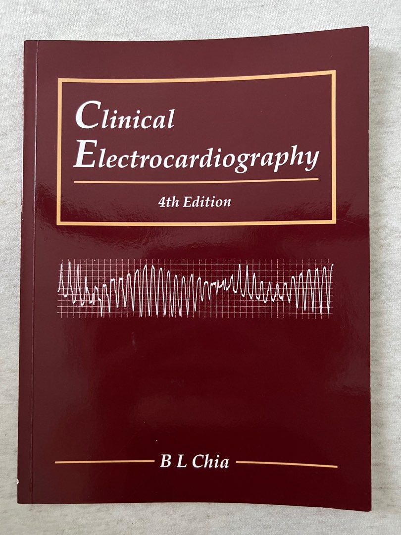 ECG Handbook Guide (Full detailed interpretation), Hobbies & Toys ...