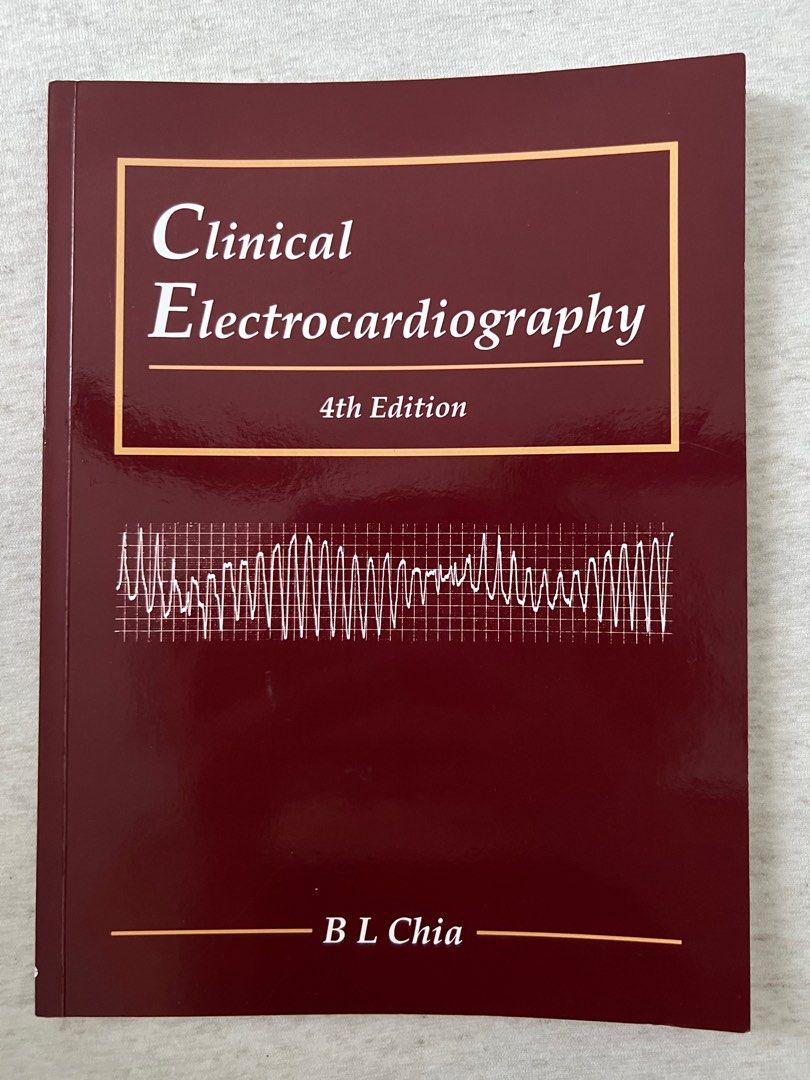 ECG Handbook Guide (Full detailed interpretation), Hobbies & Toys ...