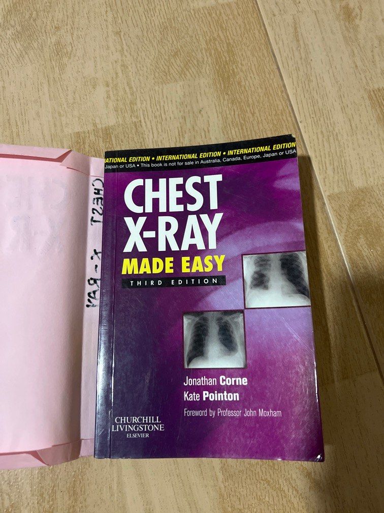 Chest X- ray made easy book , Hobbies & Toys, Books & Magazines ...
