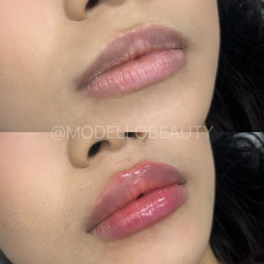 BB Lip Reshaping, Beauty & Personal Care, Face, Face Care on Carousell