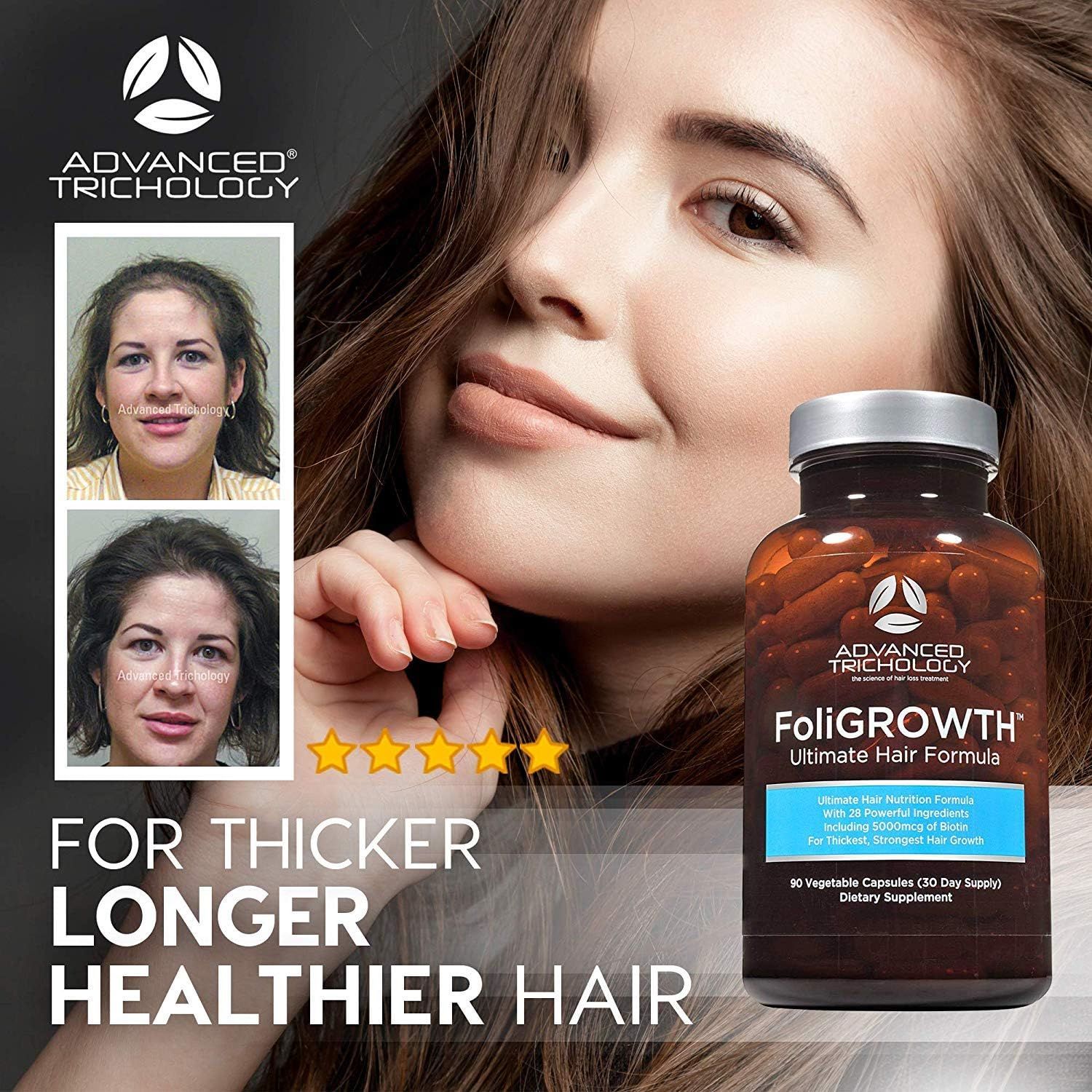 Advanced Trichology FoliGROWTH Ultimate Nutraceutical-Get Thicker Hair ...