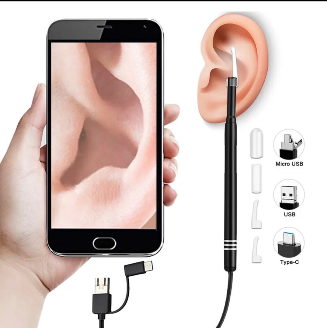 Smart Visual Medico Otoscopio Ear Cleaner Ear Endoscope Earpick Camera ...