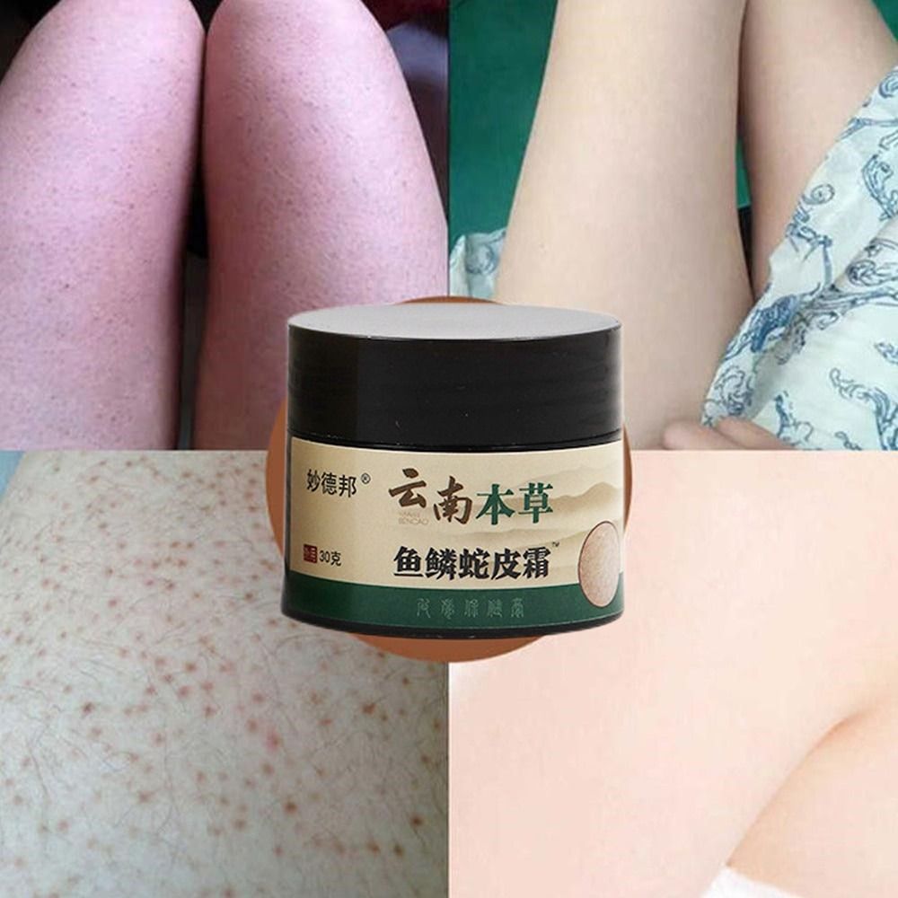 Repair Chicken Skin Cream Curing Body Dark Spot Keratosis Follicle