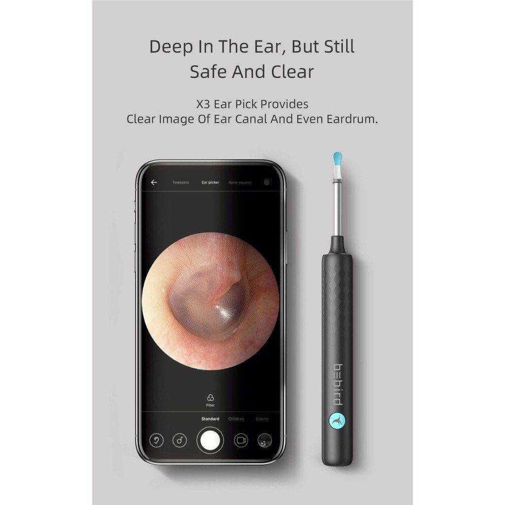 BeBird X3 Smart Otoscope Ear Cleaning Tool with Camera, Beauty ...