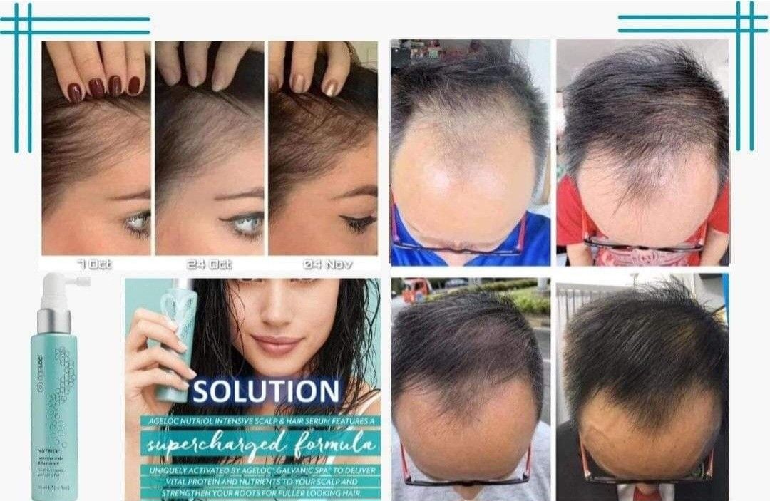 Ageloc Nutriol Intensive Scalp and Hair Serum, Beauty & Personal Care ...