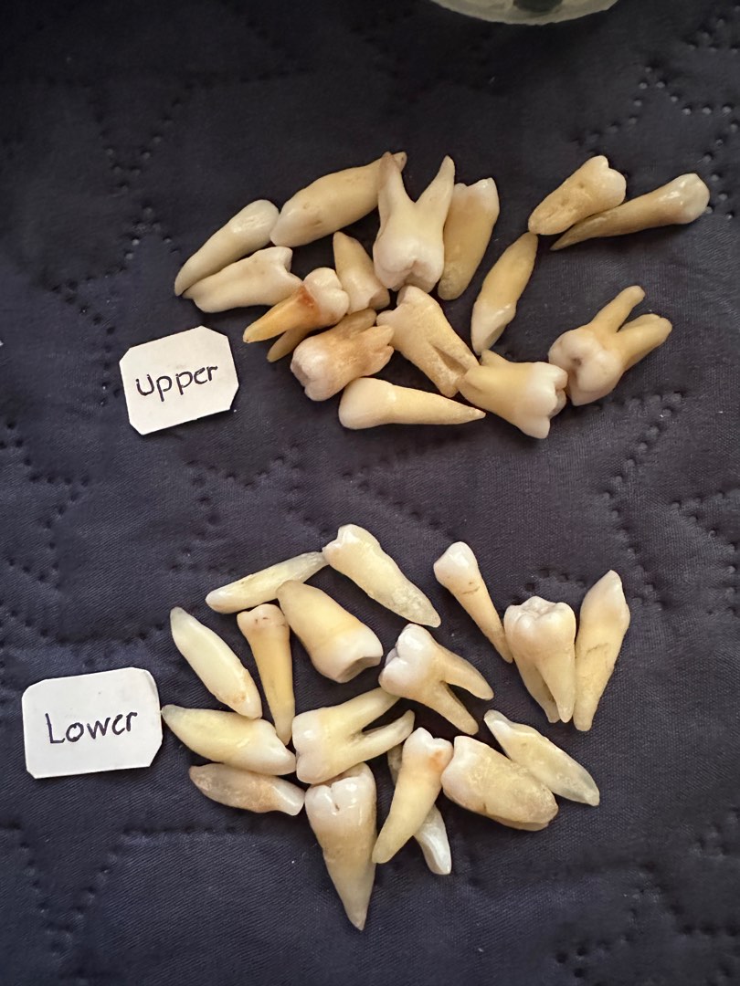 Natural Tooth Specimen, Everything Else, Looking For on Carousell