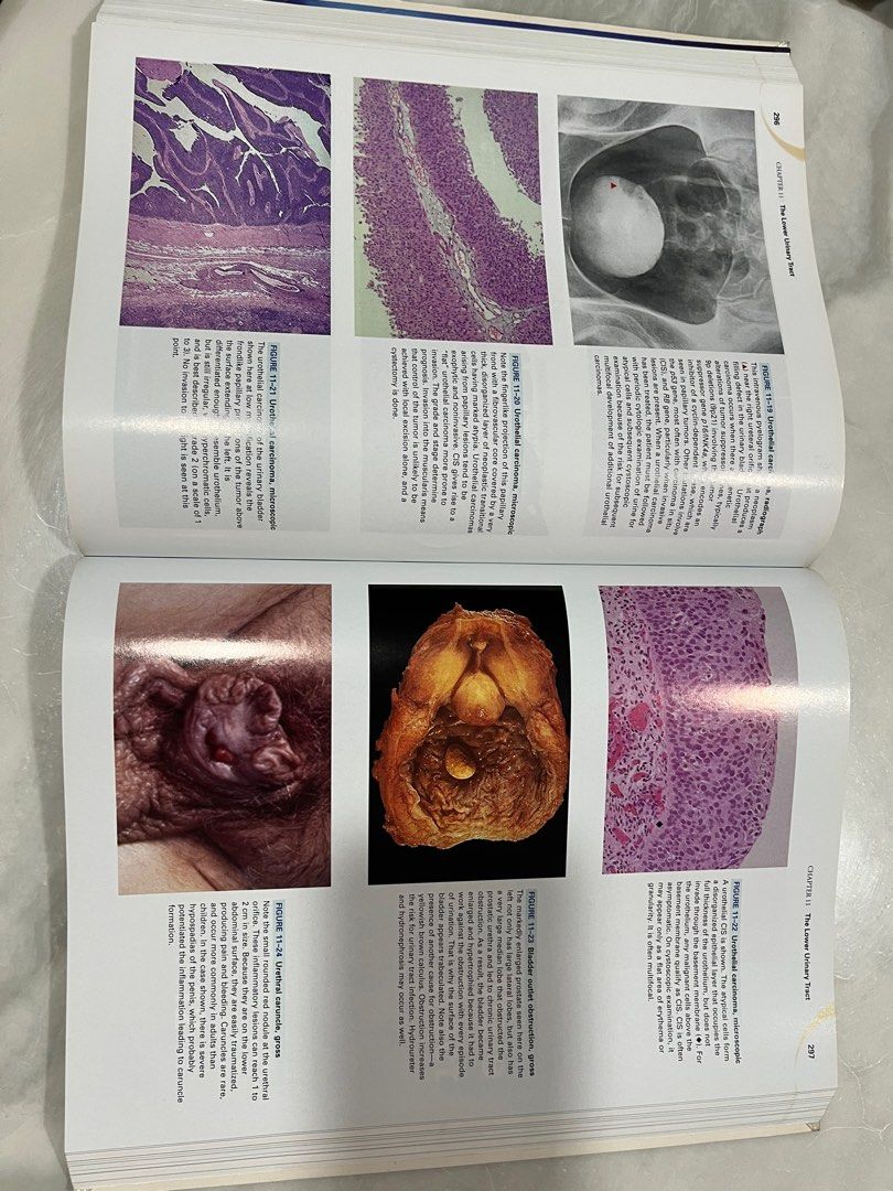 Atlas of Pathology, Hobbies & Toys, Books & Magazines, Textbooks on ...