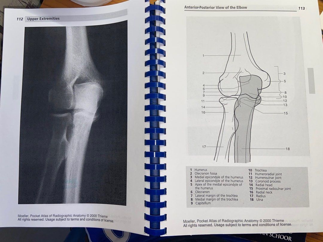 Pocket atlas of radiographic anatomy 影印本 放射 醫療 護士 醫生書, 興趣及遊戲, 書本 & 文具 ...