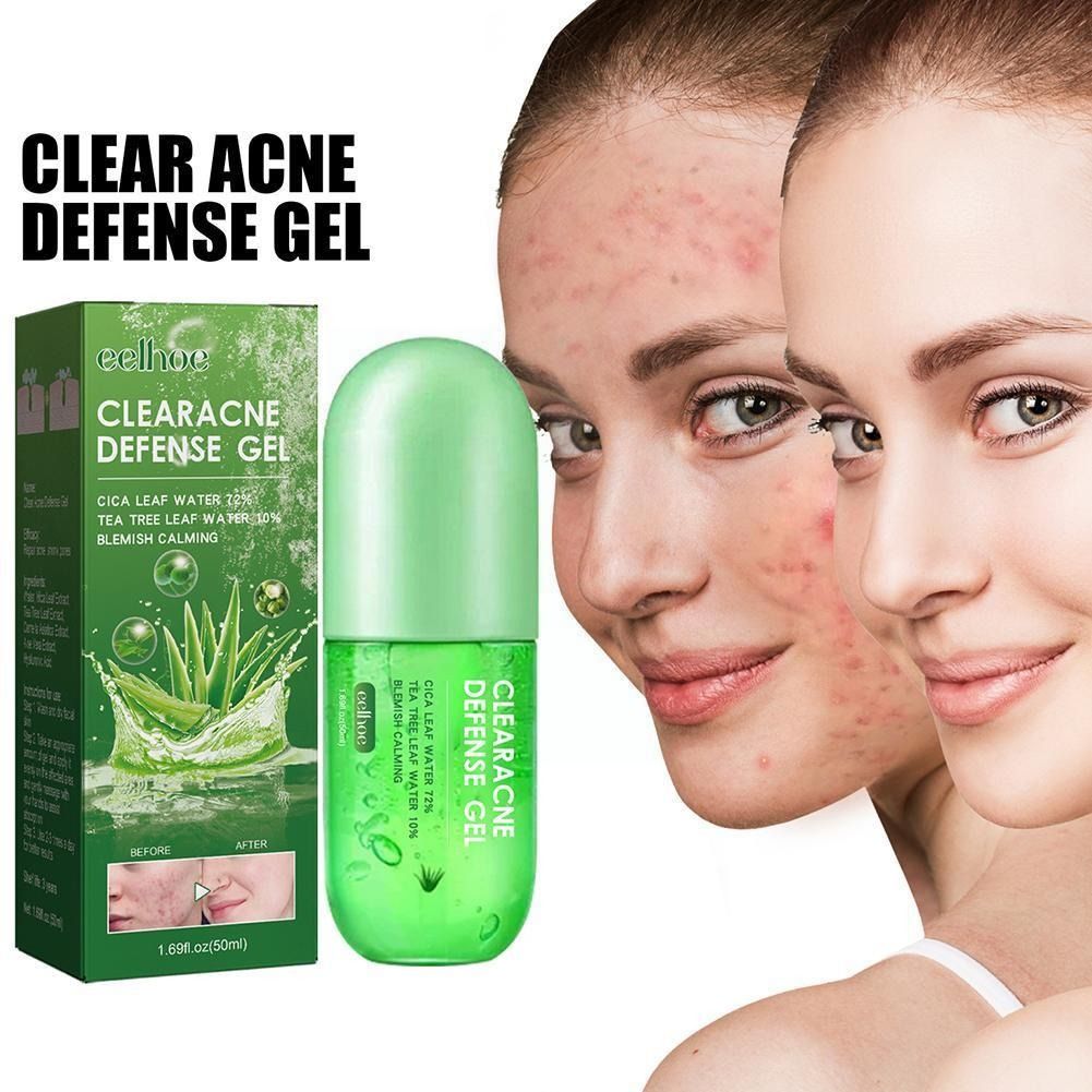 Aloe Vera Gel ClearAcne Defense Treatment Remove Acne Care Body Sunburn ...