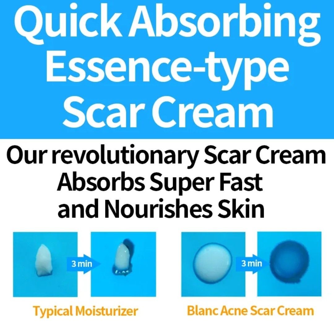 [ Blanc Nature Acne Scar Cream / Snail Cream / No.1 in Removing Acne ...