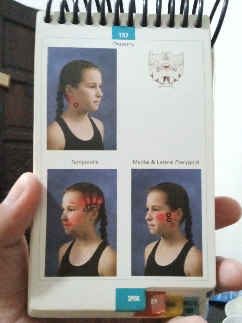 [FA DAVIS] Ortho Notes: Clinical Pocket Guide, Hobbies & Toys, Books ...