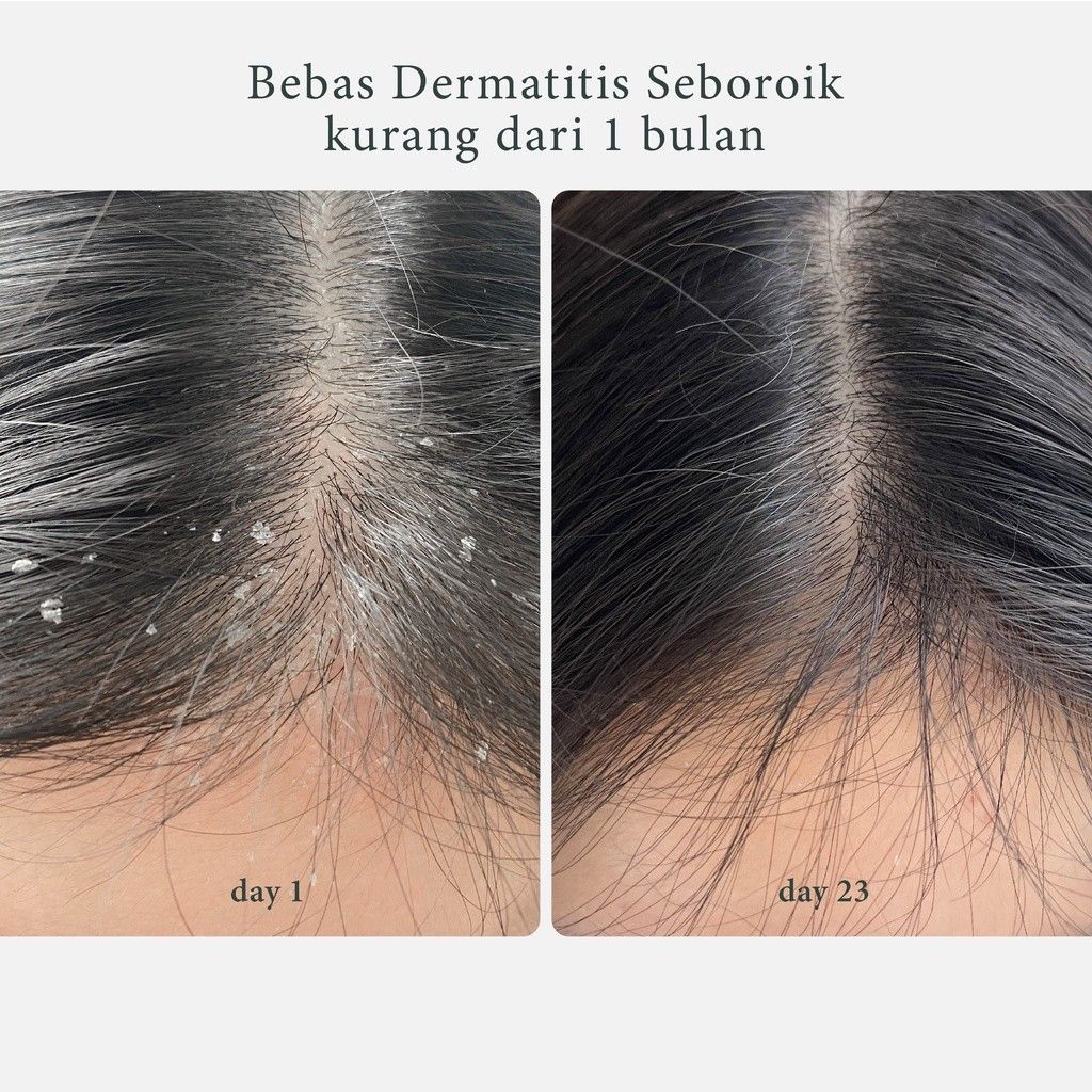 SHRD Nutra Therapy Keratin Shampoo 250ml | Cocok untuk Dermatitis ...