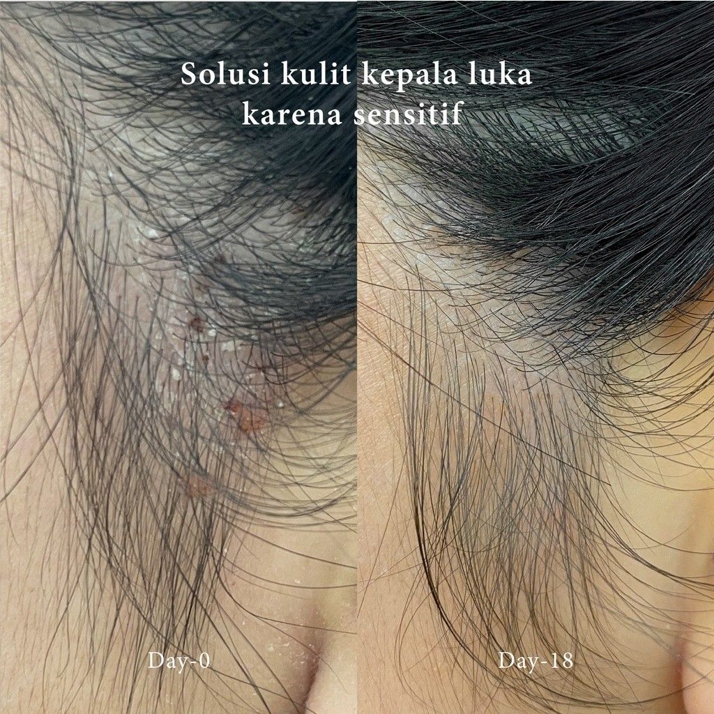 SHRD Nutra Therapy Keratin Shampoo 250ml | Cocok untuk Dermatitis ...