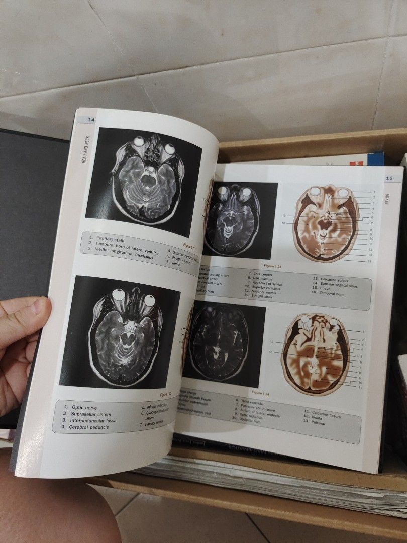 Anatomy CT & MRI, Hobbies & Toys, Books & Magazines, Textbooks on Carousell
