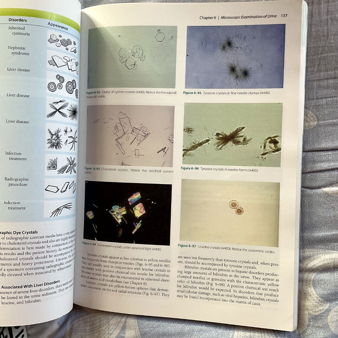 Strasinger AUBF Urinalysis and Body Fluids 6th ed Medtech Book, Hobbies ...
