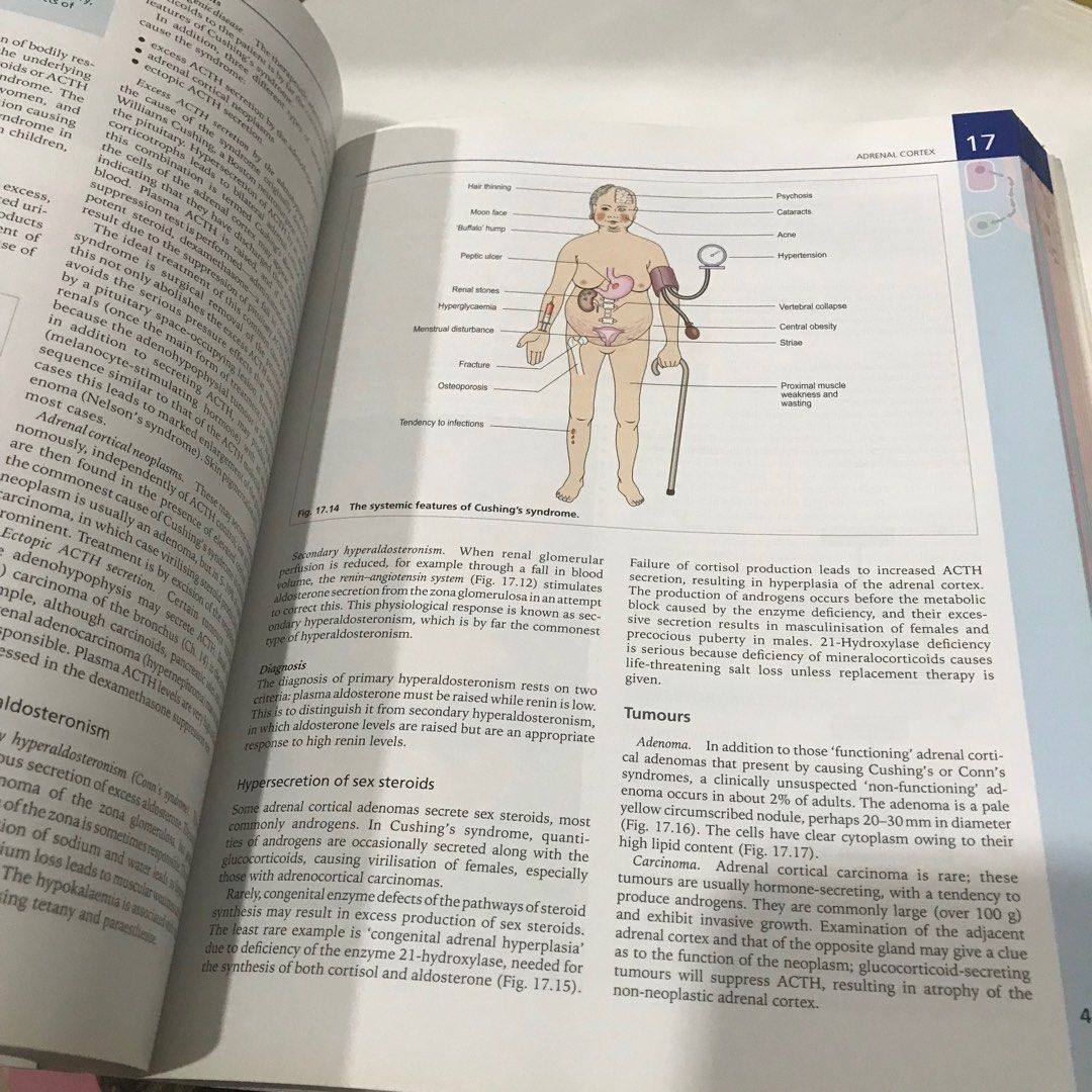 General and Systemic Pathology 5th Edition, Hobbies & Toys, Books ...