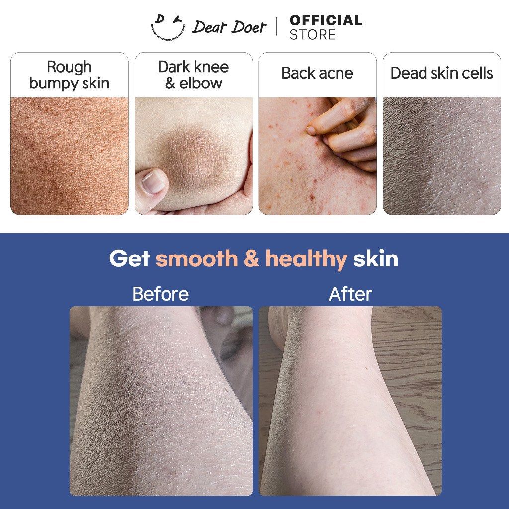 [Dear Doer] Vegan Body Scrub, Natural Exfoliating Body Scrub ...