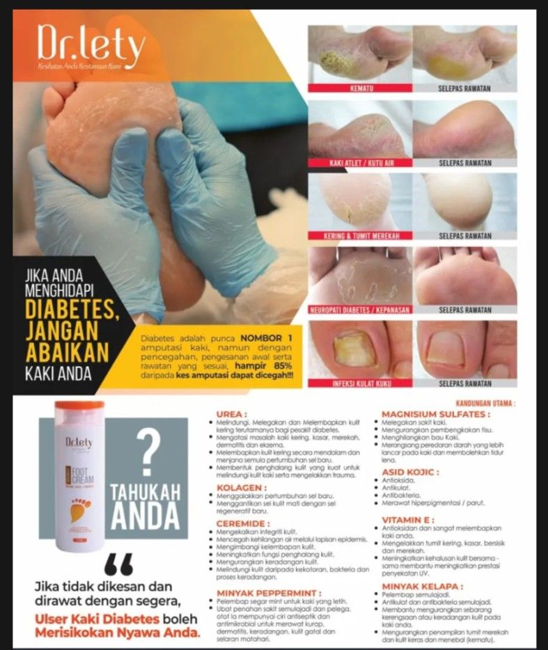 Dr.Lety advanced foot cream, Beauty & Personal Care, Foot Care on Carousell