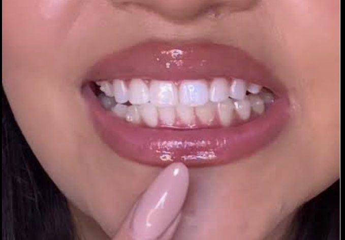 (INSTOCK x 2) HiSmile Glostik Tooth Gloss, Beauty & Personal Care, Face ...