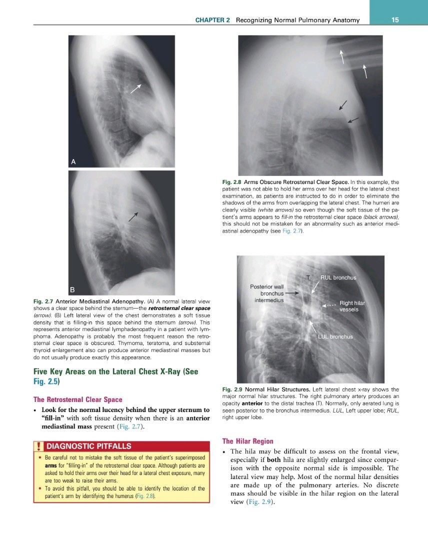 Learning Radiology by William Herring 5th edition, Hobbies & Toys ...