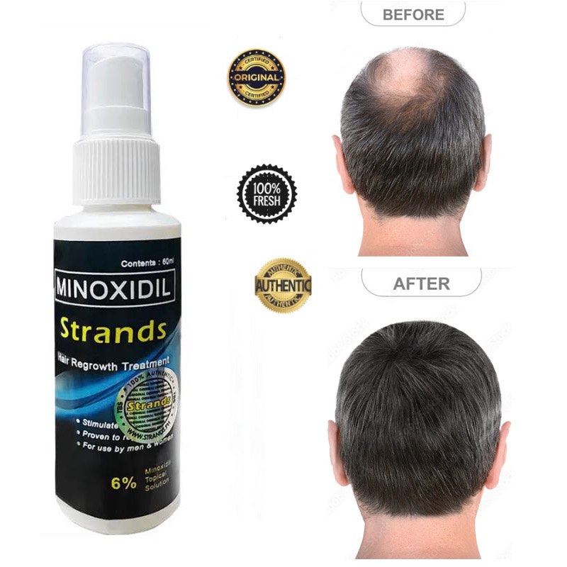 Original Minoxidil Strands Hair Grower, Beauty & Personal Care, Hair on Carousell