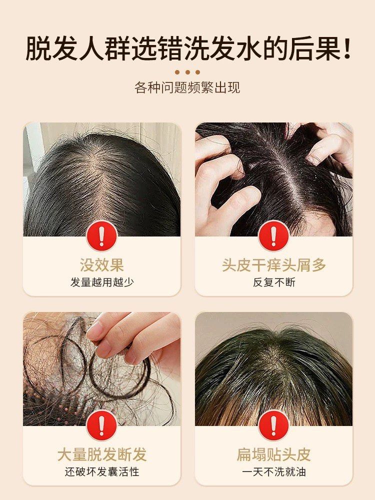 Yaopin Anti-Hair Loss Shampoo, Beauty & Personal Care, Hair on Carousell