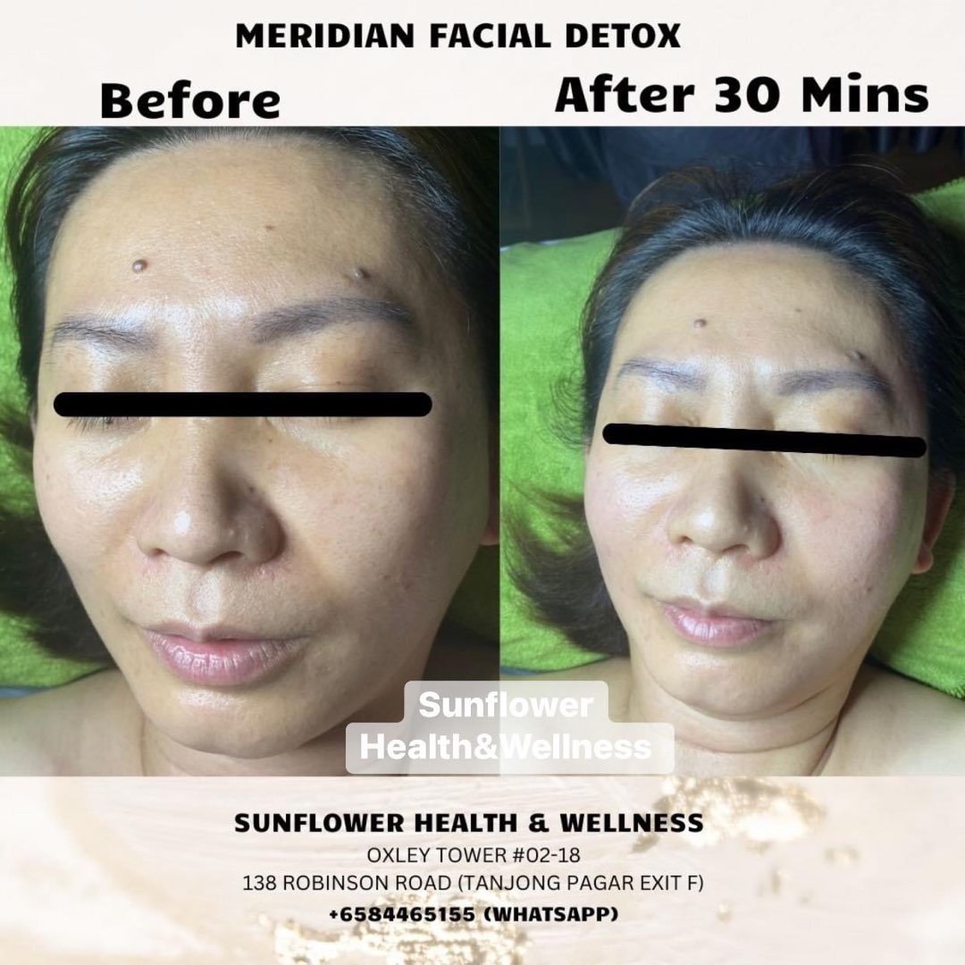 Bojin therapy, Lifestyle Services, Beauty & Health Services on Carousell