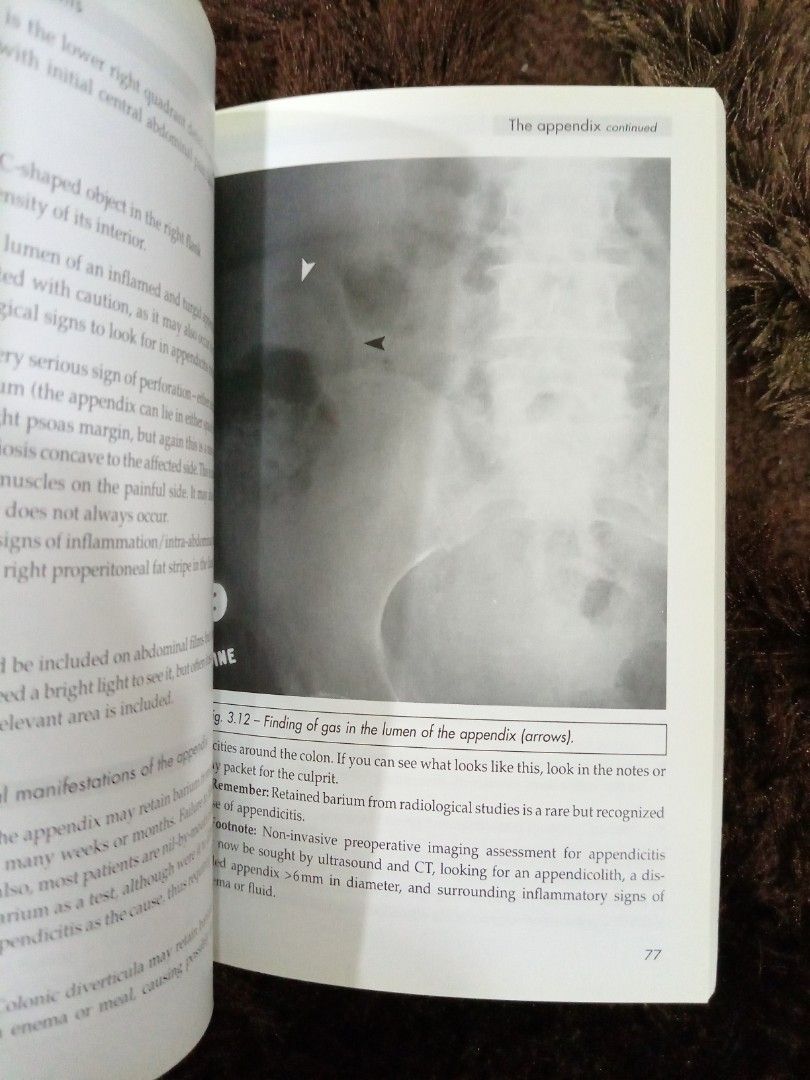 Abdominal x-rays made easy, Hobbies & Toys, Books & Magazines ...
