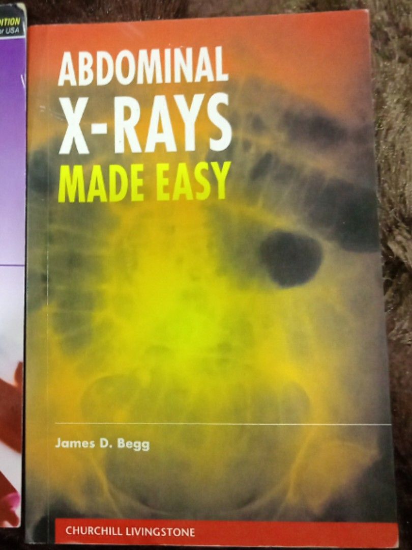 Abdominal x-rays made easy, Hobbies & Toys, Books & Magazines ...