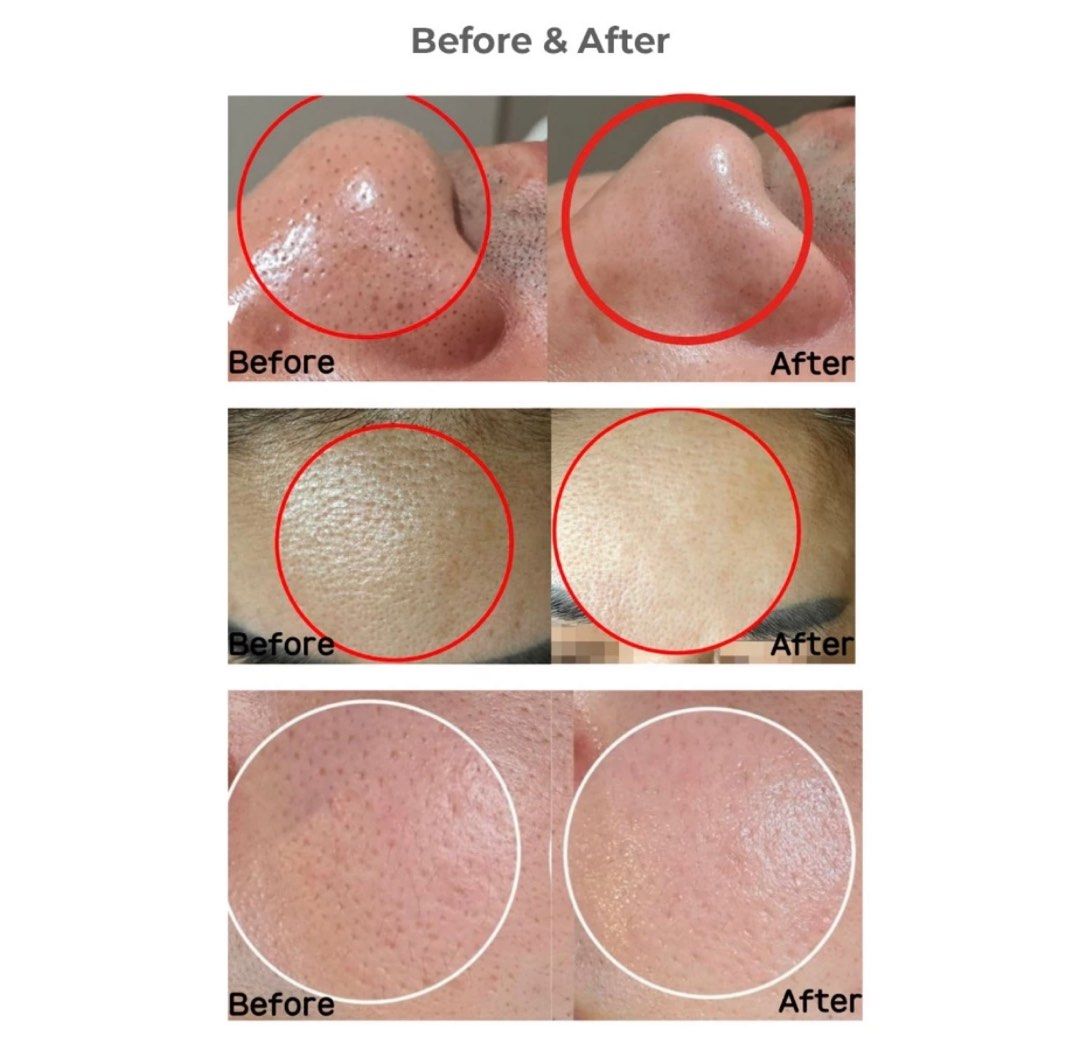 Conapidil Cementsheet (5 sheets), Beauty & Personal Care, Face, Face ...