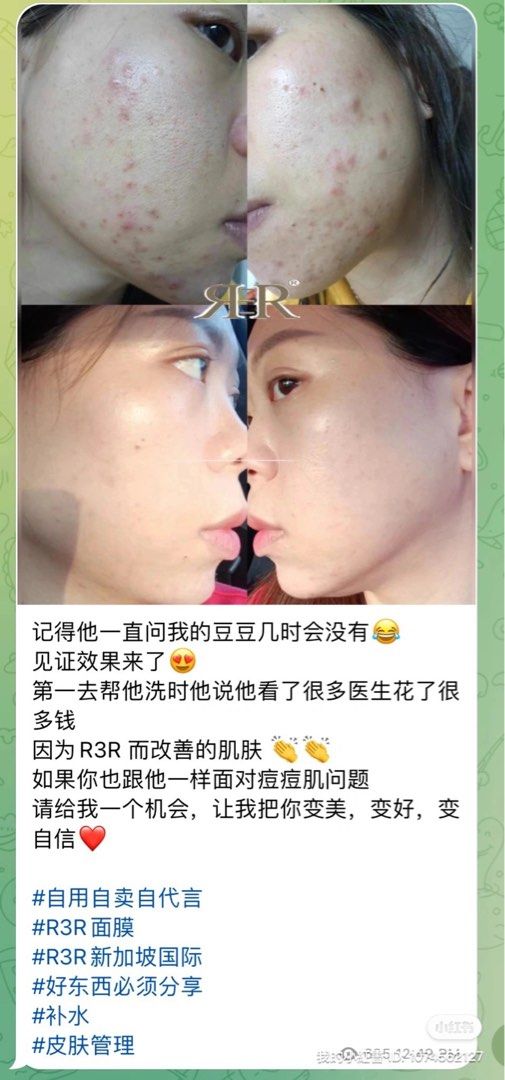 R3R facial product, Beauty & Personal Care, Face, Face Care on Carousell