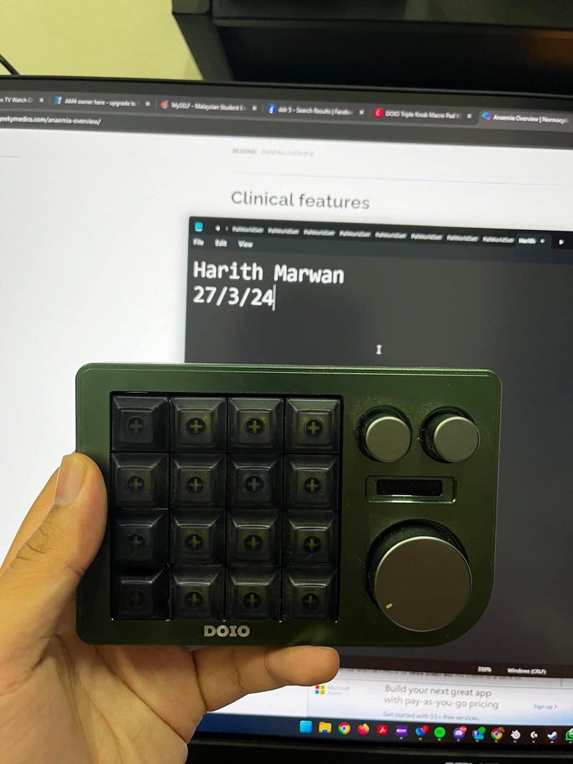 Doio Kb-16 Macropad, Computers & Tech, Parts & Accessories, Computer Keyboard on Carousell