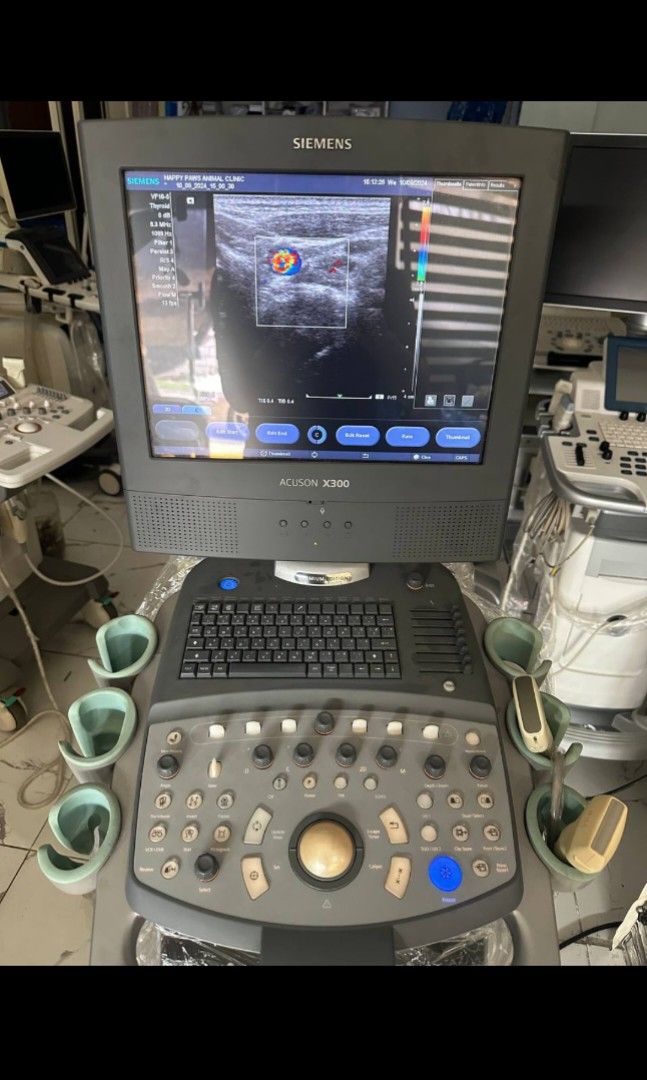 Ultrasound Siemens Acuson X300 (Convex And Linear probes), Health ...