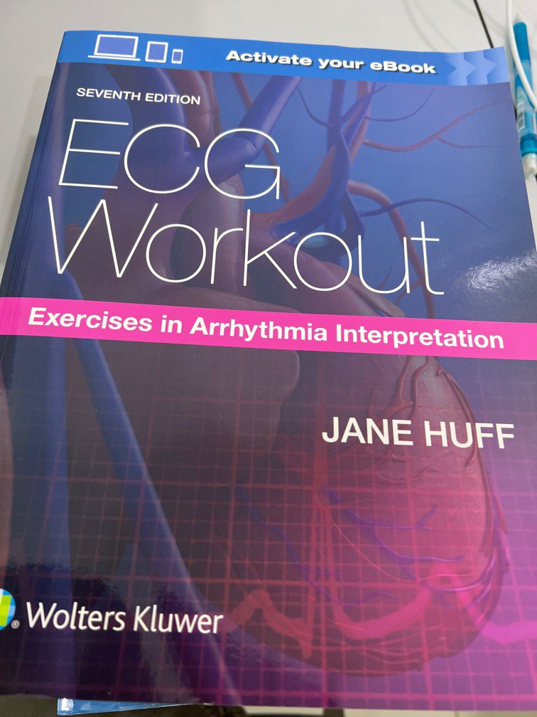 ECG WORKOUT 7e Exercises in Arrhythmia Interpretation, Hobbies & Toys ...