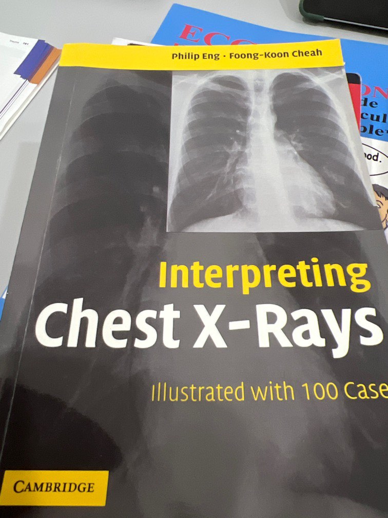 Interpreting Chest X rays illustrated with 100 Cases, Hobbies & Toys ...