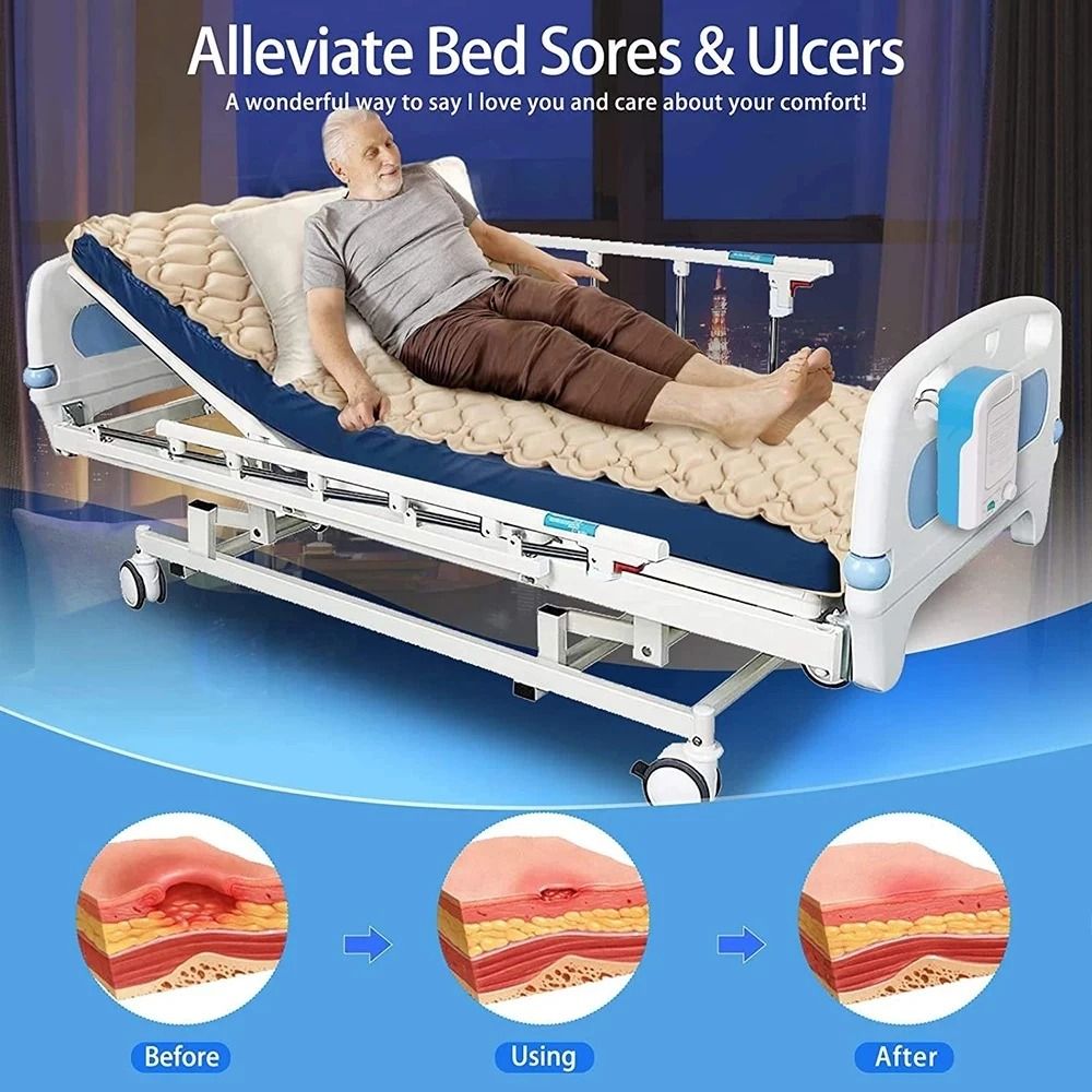 Medical Air Mattress Anti Decubitus Bubble Tube Ripple Mattress ...