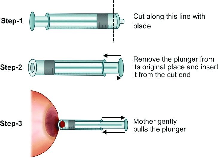 Inverted Nipple Syringe, Babies & Kids, Nursing & Feeding ...